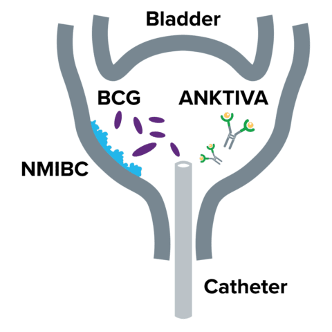Immunotherapy by ANKTIVA® - Treatment for NMIBC CIS