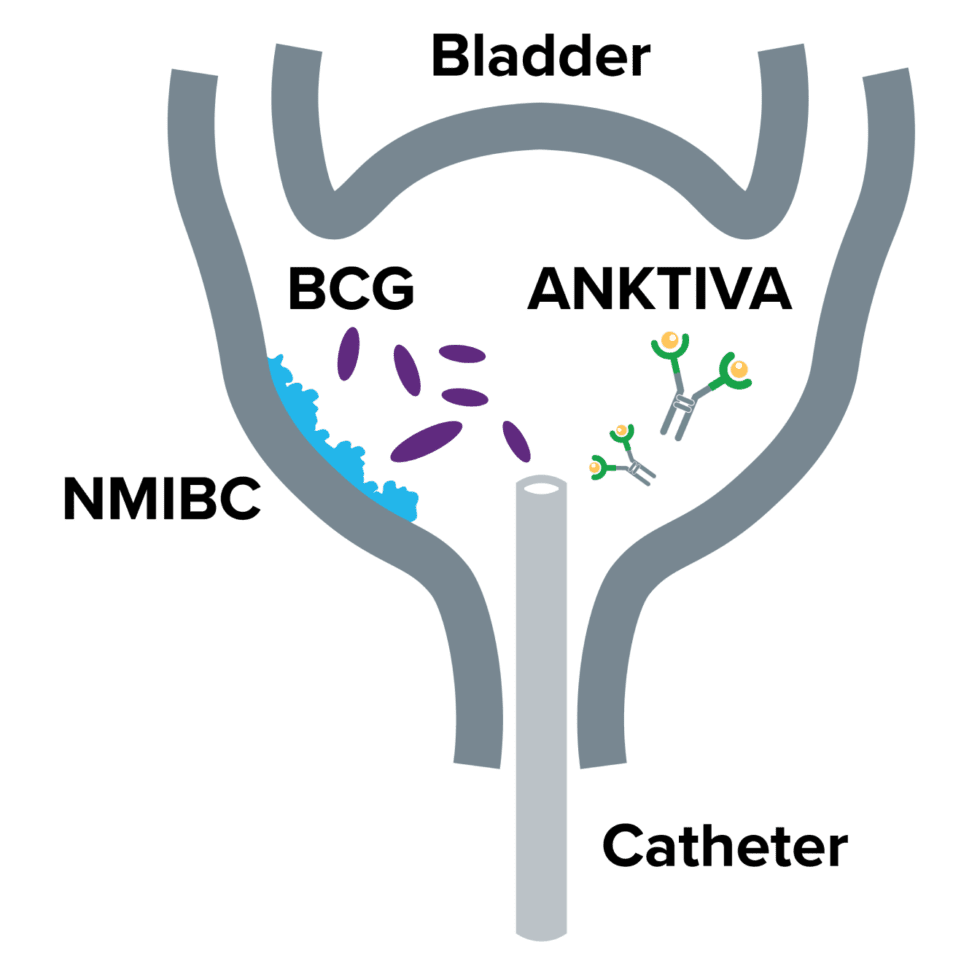 Immunotherapy by ANKTIVA® - Treatment for NMIBC CIS
